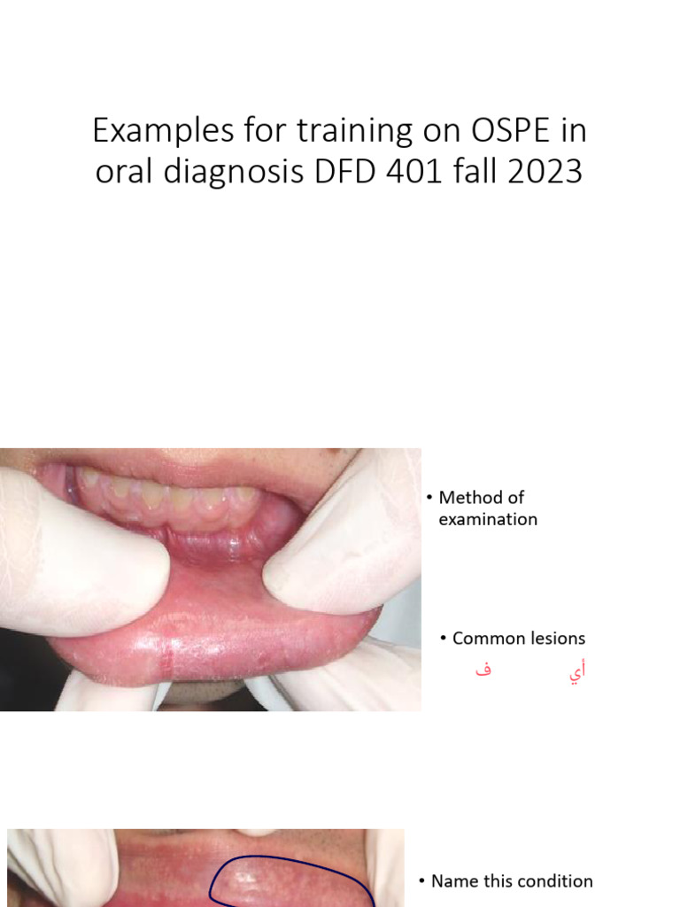 Examples For Training On OSPE in Oral Diagnosis DFD 401 Fall 2023 | PDF | Clinical Medicine ...