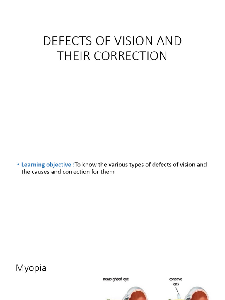 1720691157931.topic 2 Defects of Vision and Their Correction | PDF