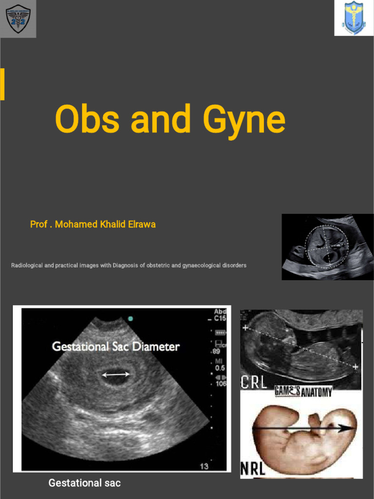Obs and Gyne Radiology | PDF