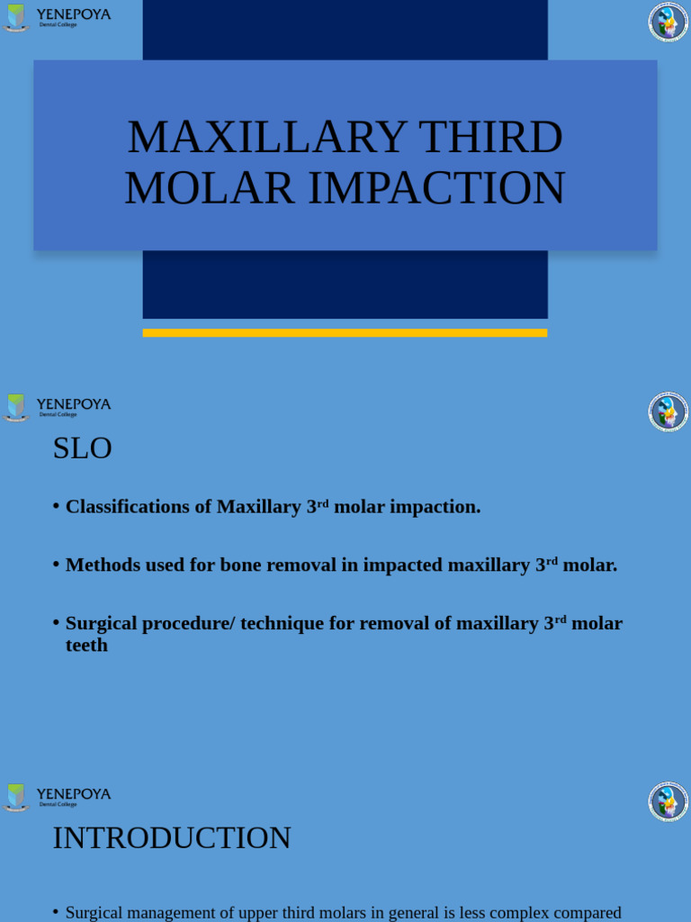 1 Maxillary Third Molar Canine Impaction | PDF | Dental Anatomy | Tooth