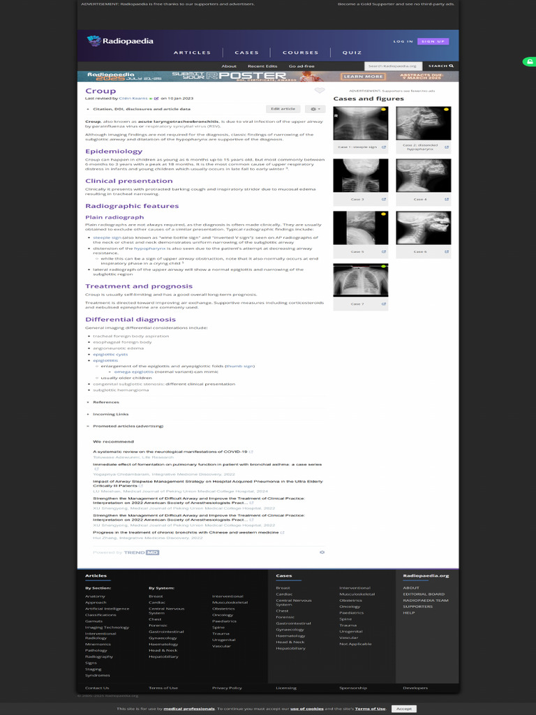 Croup Radiology Reference Article Radiopaedia Org 01-21-2025!10!26 PM | PDF