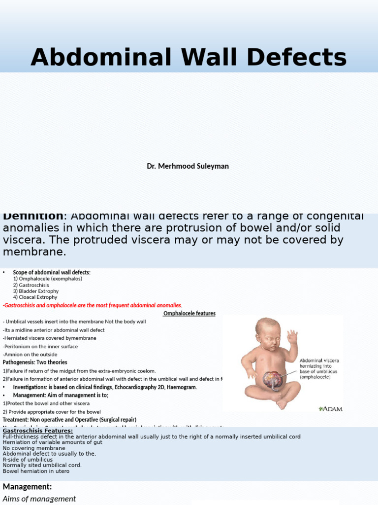 Abdominal Wall Defects DR Merhmood Suleyman | PDF