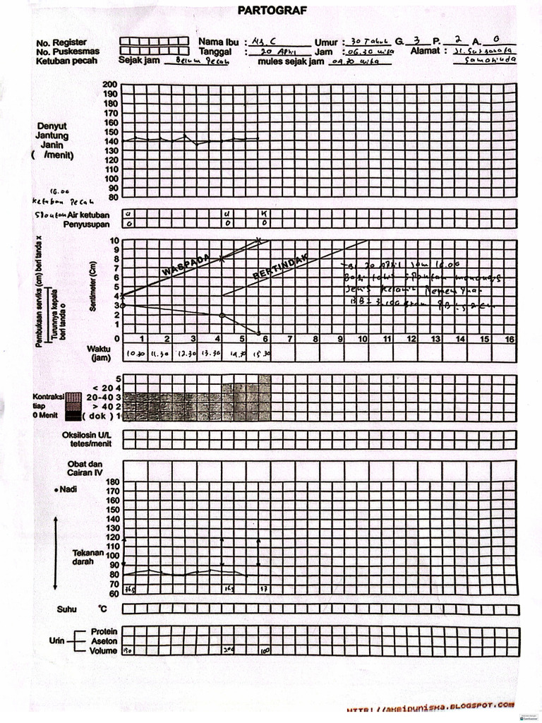 Partograf - Yoga Fix | PDF
