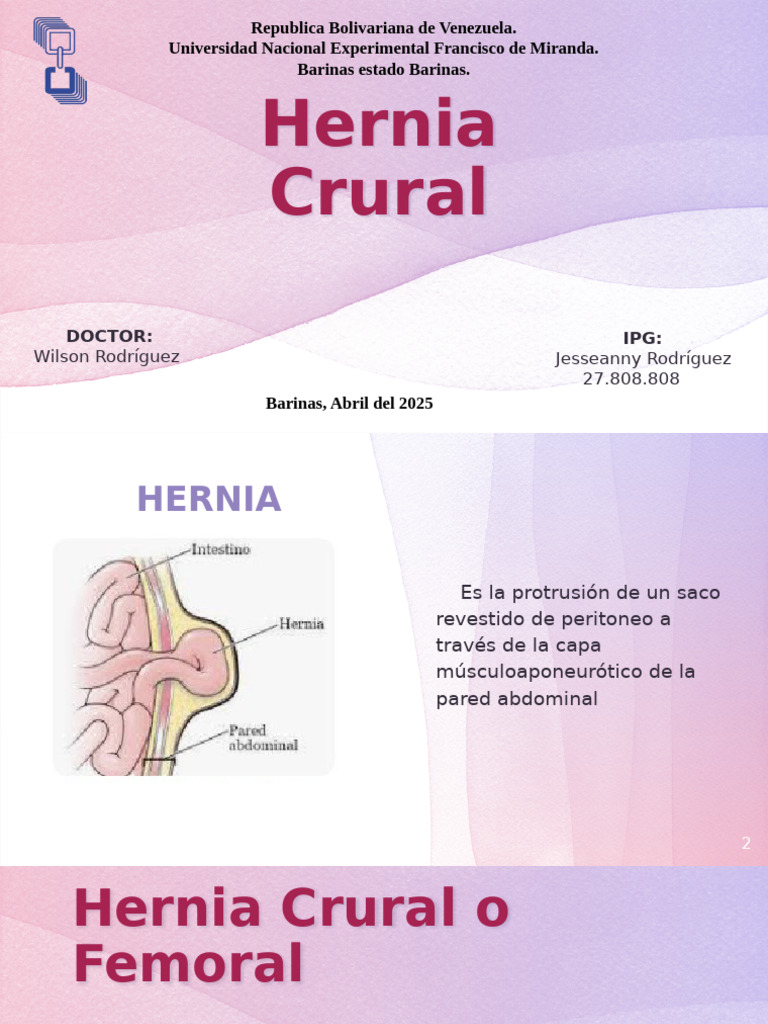 Hernia Crural | PDF | Abdomen