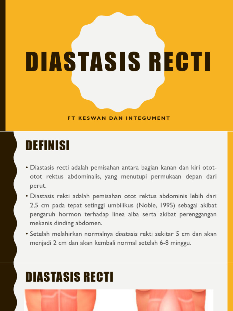 FT Keswan - Diastasis Recti | PDF