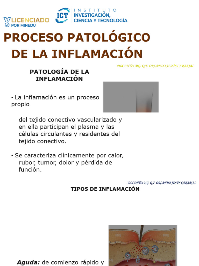 Clase 06 - Proceso Patológico de La Inflamación | PDF | Inflamación ...