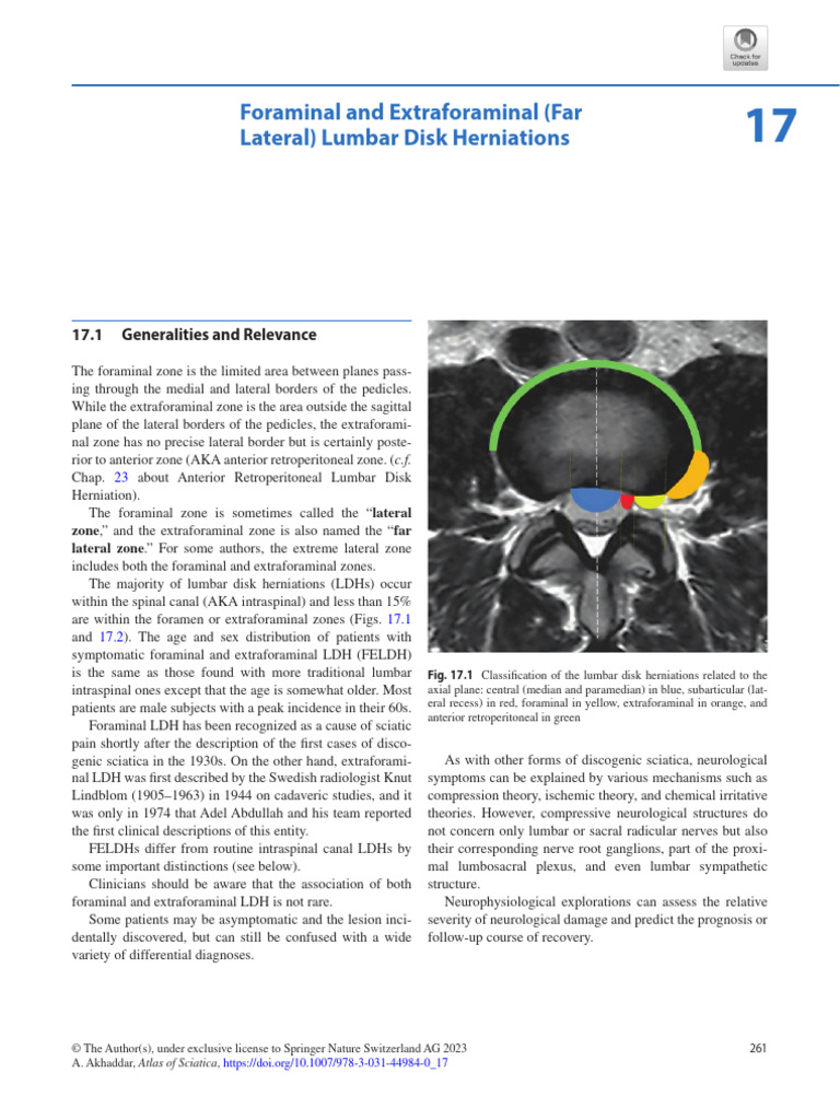 Foraminal & Extra Foraminal Nerve Conpression | PDF | Vertebra | Human ...