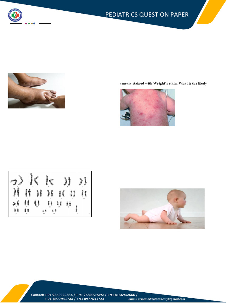 T & D - Pediatrics Question Paper | PDF | Pneumonia | Hepatitis