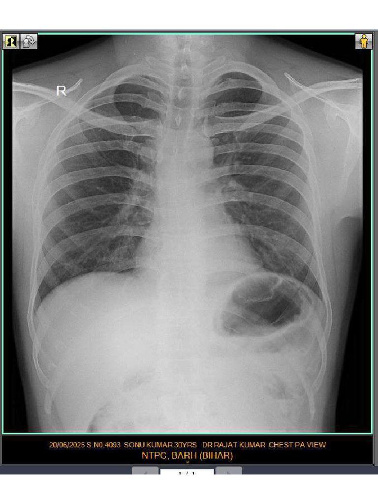 4093 Sonu Kumar | PDF