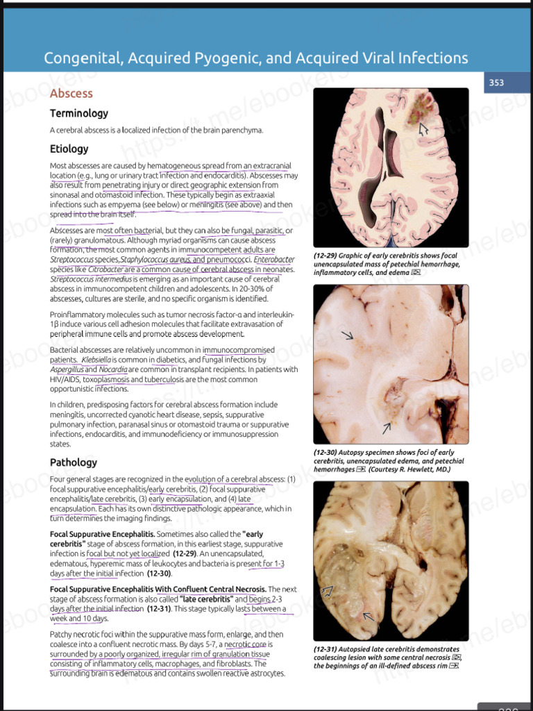 Cerebral Abscess | PDF