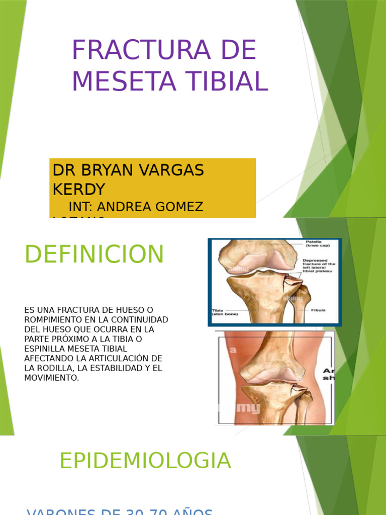 Fractura Meseta Tibial Pdf Rodilla Sistema Esquelético