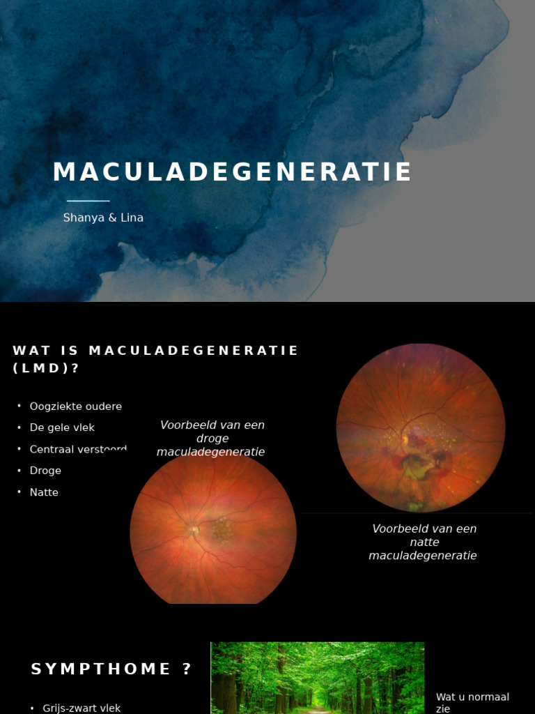 Macula Degenerat I e | PDF