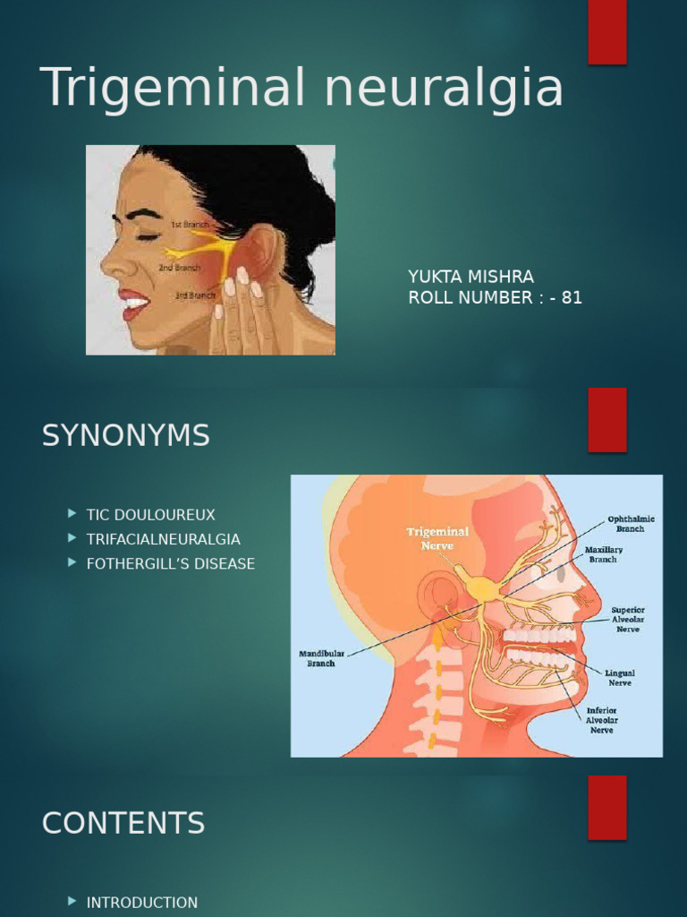 Trigeminal Neuralgia | PDF | Neurological Disorders | Nervous System