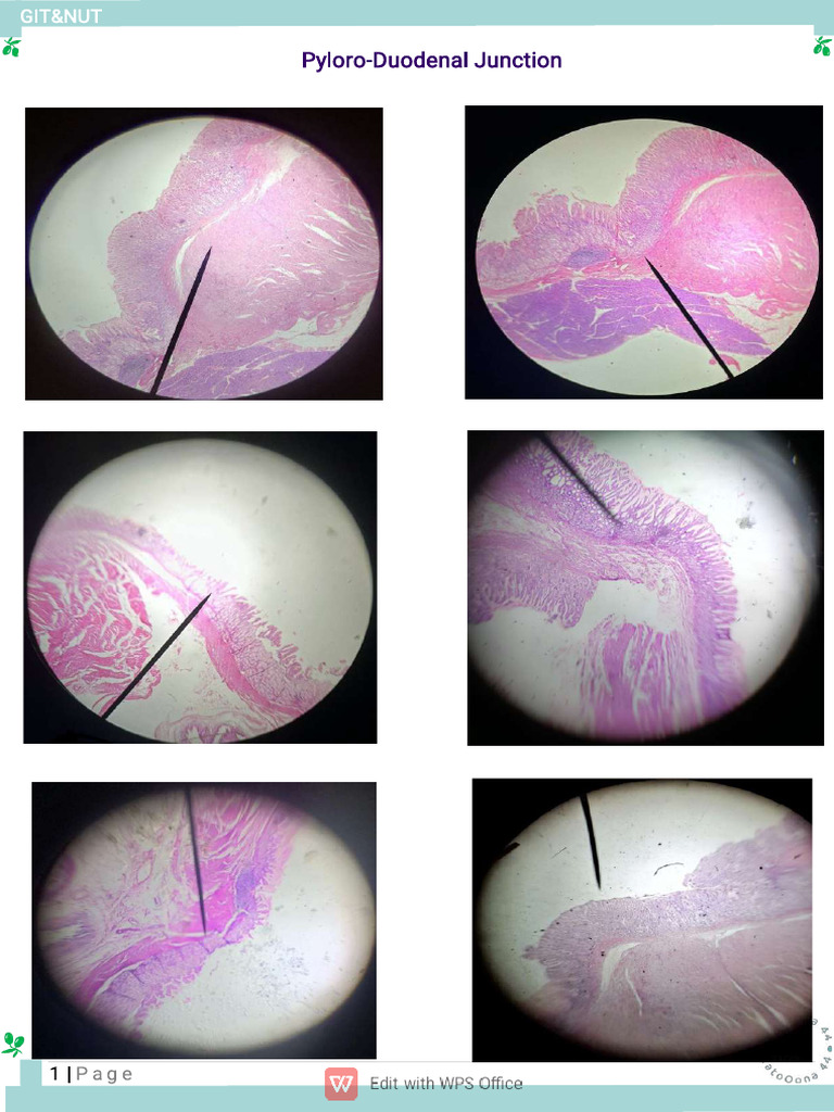 Histo Pract Git 2 Compressed 250612 224637 | PDF