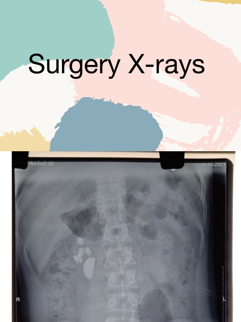 X-ray Findings and Diagnoses Summary | PDF
