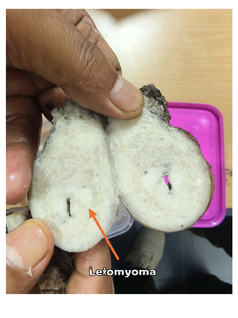 Patho Specimen | PDF