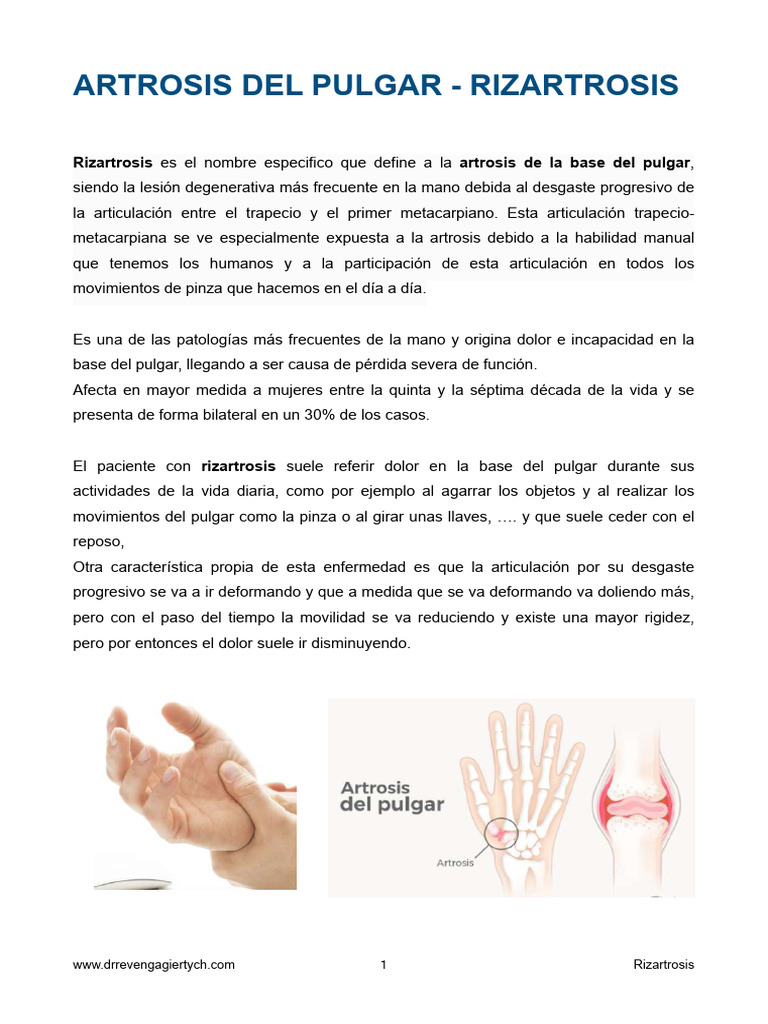 Rizartrosis Artrosis Pulgar Compressed | PDF | Osteoartritis | Medicina
