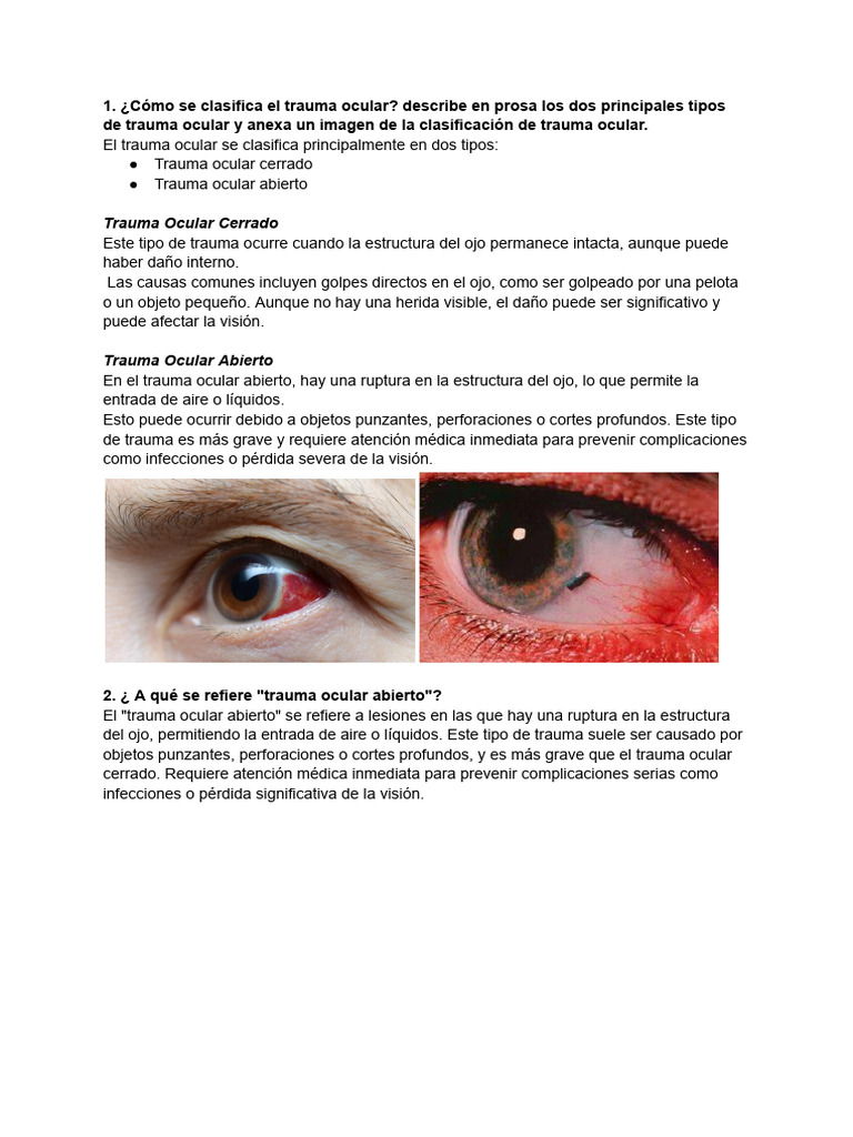 Trauma Ocular | PDF | Percepción visual | Ojo