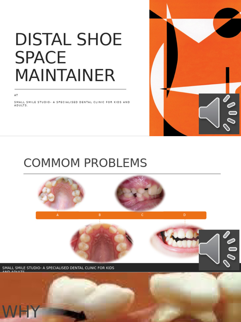 Distal Shoe Space Maintainer | PDF