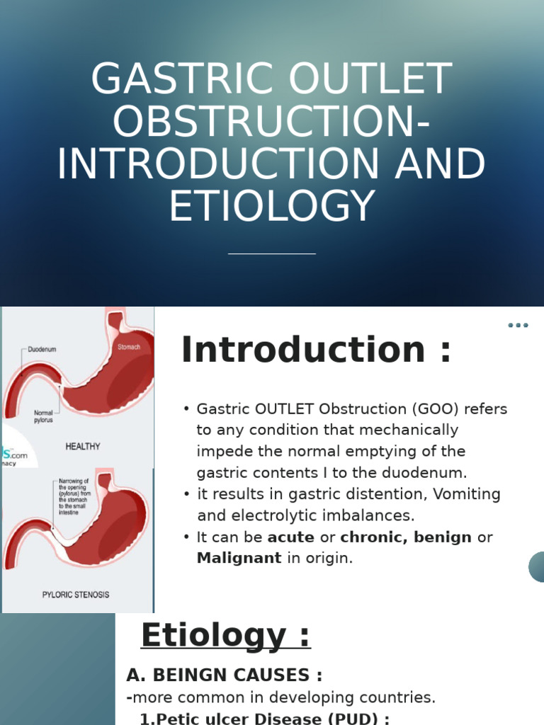 Gastric Outlet Obstruction 20250610 142459 0000 | PDF