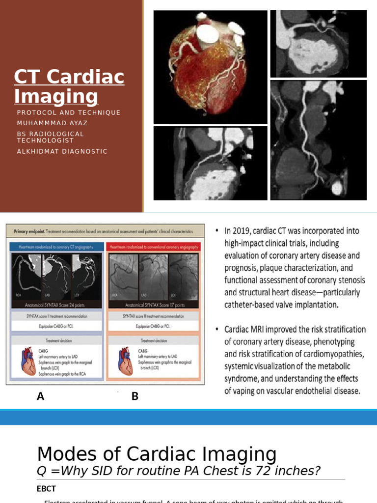 CT Cardiac Protocols | PDF | Coronary Circulation | Heart