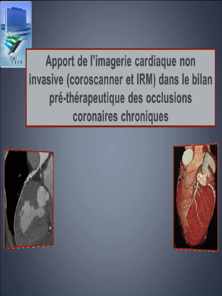 Apport du coroscanner en occlusions coronaires | PDF | Dispositif ...