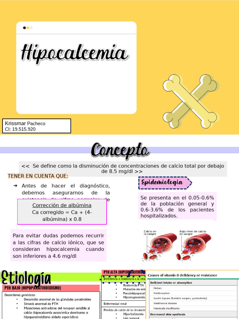 Hipocalcemia Kriss | PDF | Glándula paratiroidea | Calcio