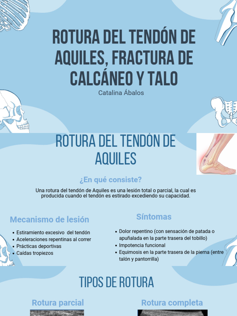 Rotura Del Tendã N de Aquiles, Fractura de Calcã¡neo y Talo | PDF ...