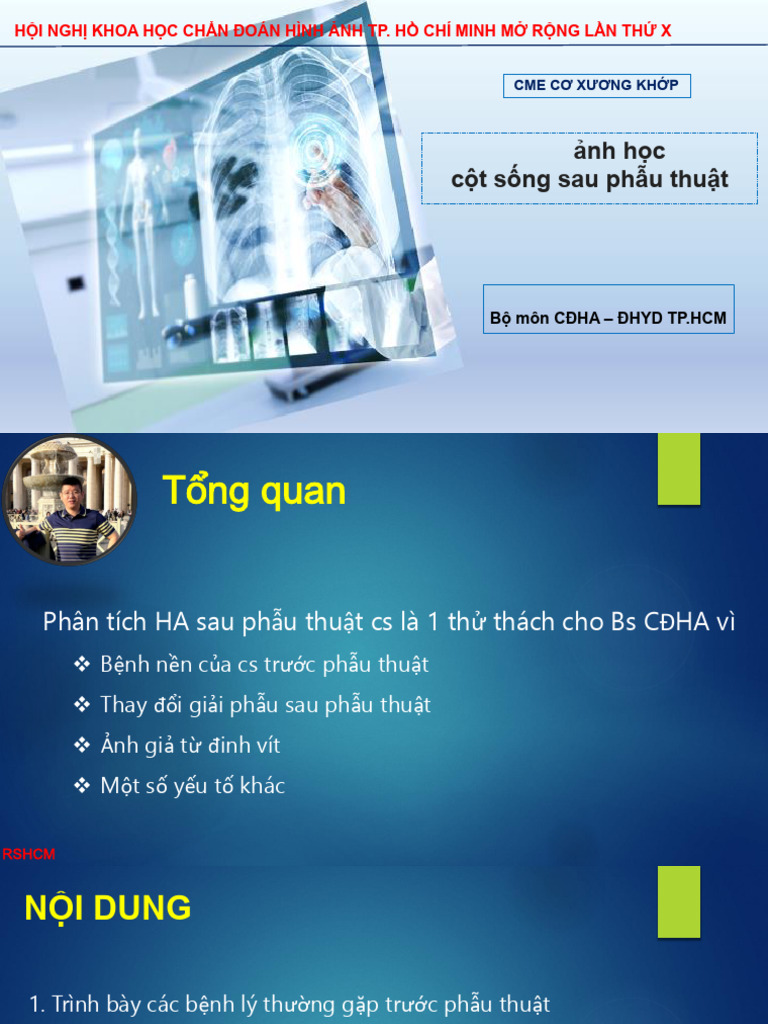 Postoperative Spine | PDF