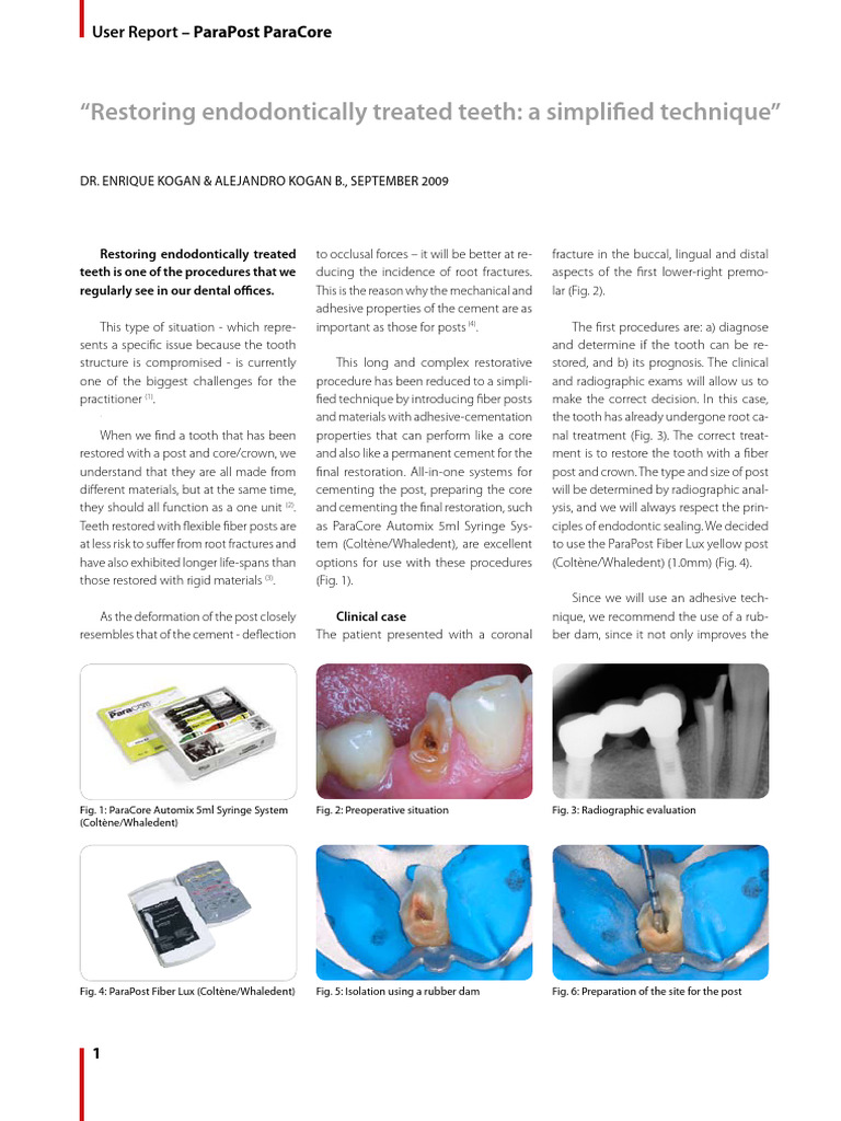 Simplified Technique for ParaPost Use | PDF | Dentistry Branches