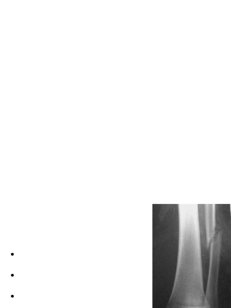 FX Tobillo | PDF | Extremidades (anatomía) | Anatomía del miembro inferior