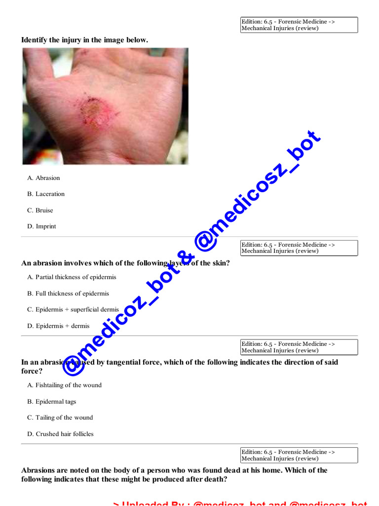 Forensic Medicine - Mechanical Injuries (Review) | PDF