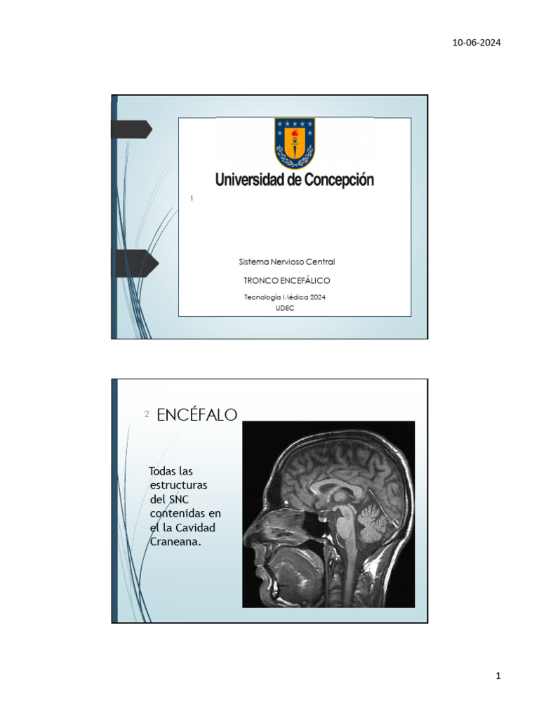 14.tronco Encefalico TM 2024 | PDF | Cerebelo | Médula espinal