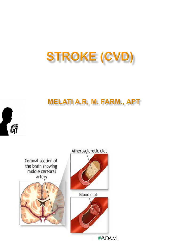 Stroke Cvd Pdf