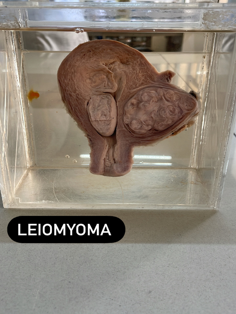 Pathopic 1 Organ Specimen Plus Labels | PDF