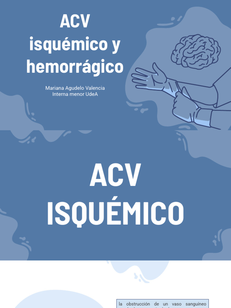 ACV Isquémico y Hemorrágico | PDF | Carrera | Hipertensión