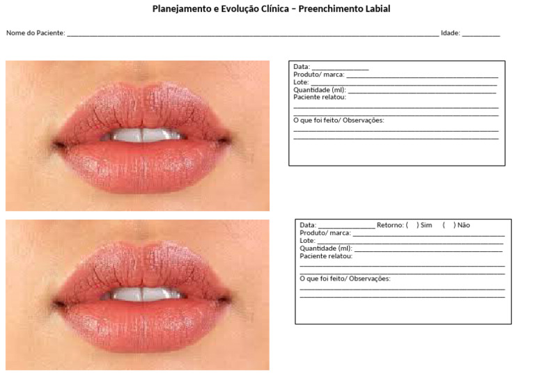 Registro de Preenchimento Labial | PDF