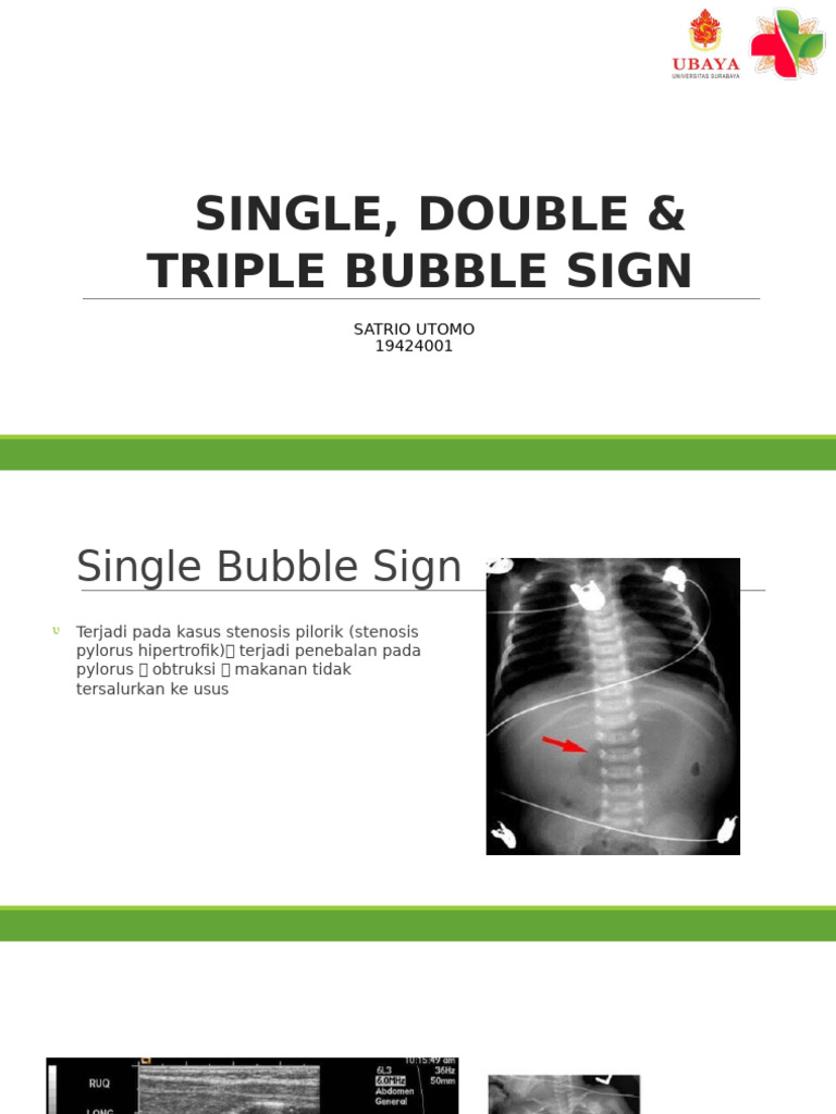 Bacaan Bof Single, Double, Triple Bubble | PDF