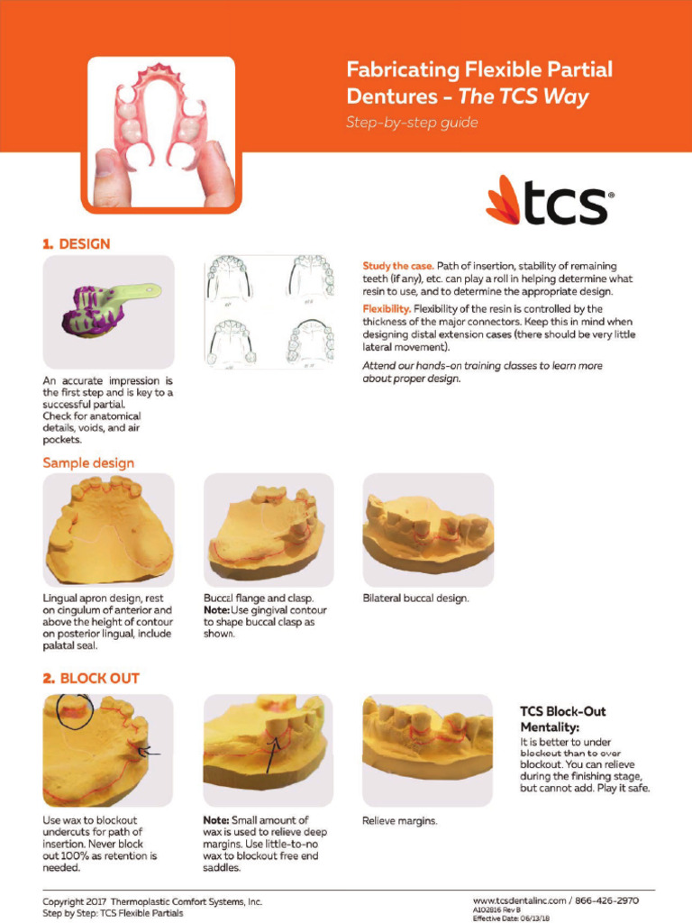 Fabricating Flexible Partials A102816 RevB | PDF