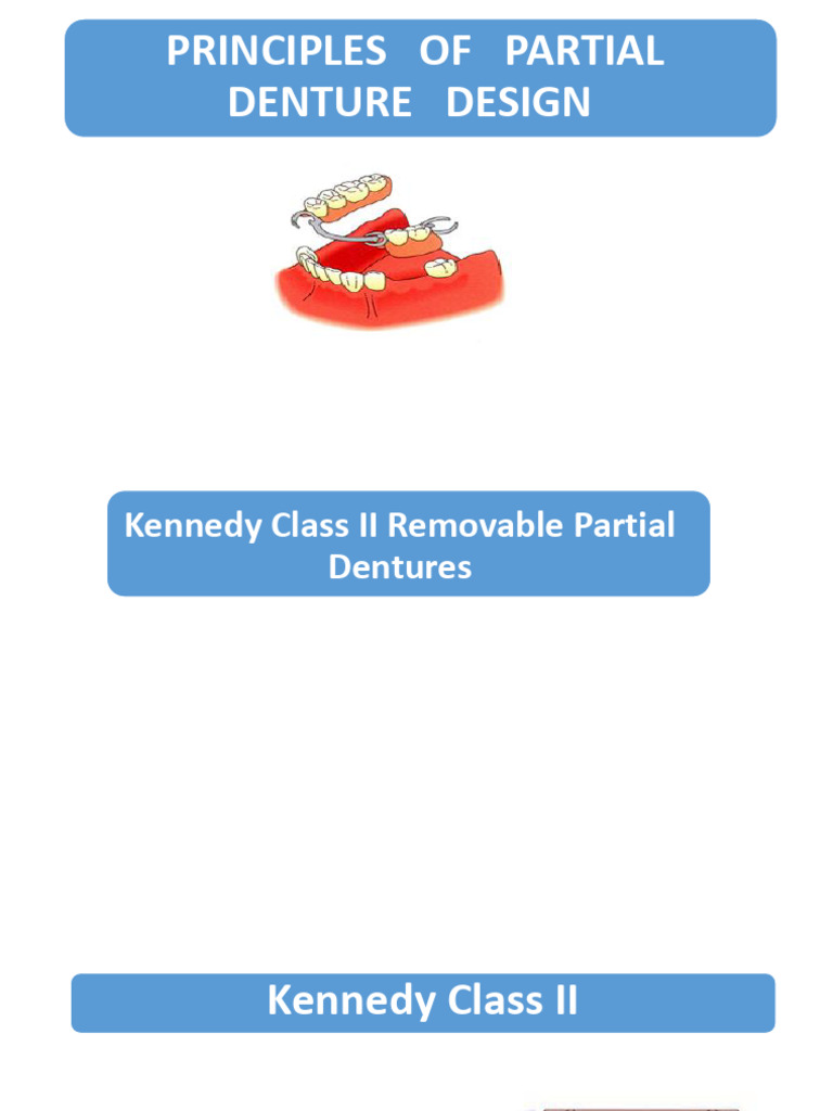 RPD Design Principles for Kennedy Classes | PDF | Dentures | Medical ...