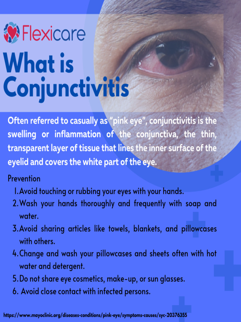 Conjunctivitis | PDF