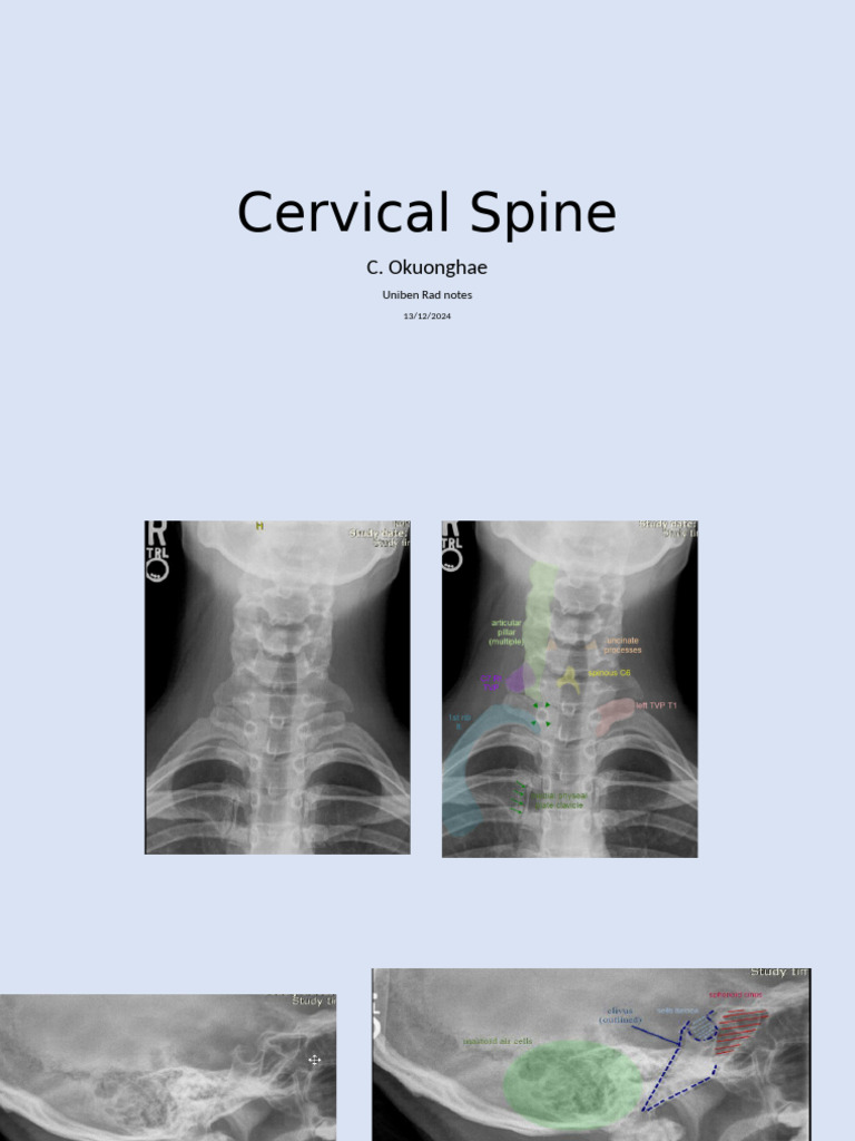 Cervical Spine | PDF
