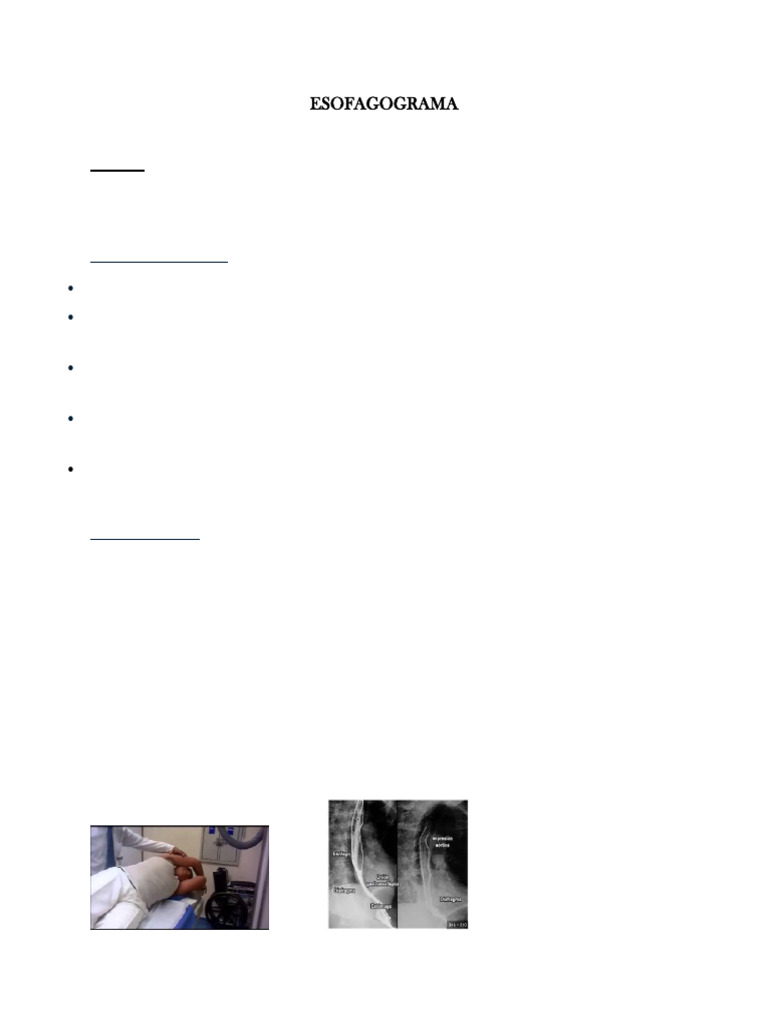 ESOFAGOGRAMA | PDF | Esófago | Intestino grueso