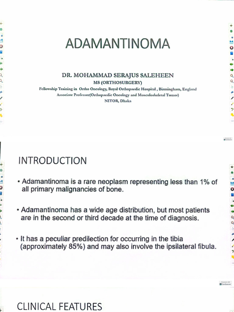 Adamantinoma and Metastatic Cancer Seraj | PDF