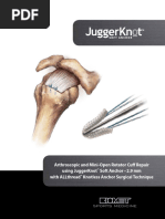 Arhtrex Knee Fibertak Anchors | PDF | Surgical Suture | Knee