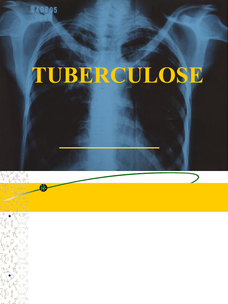 Tuberculose: Sintomas e Tratamento | PDF | Tuberculose | Mycobacterium ...