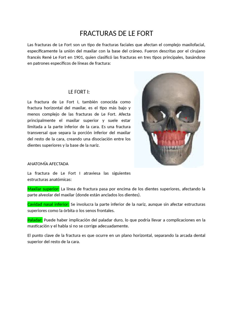 Clasificación de Fracturas de Le Fort | PDF | Cara | Cráneo