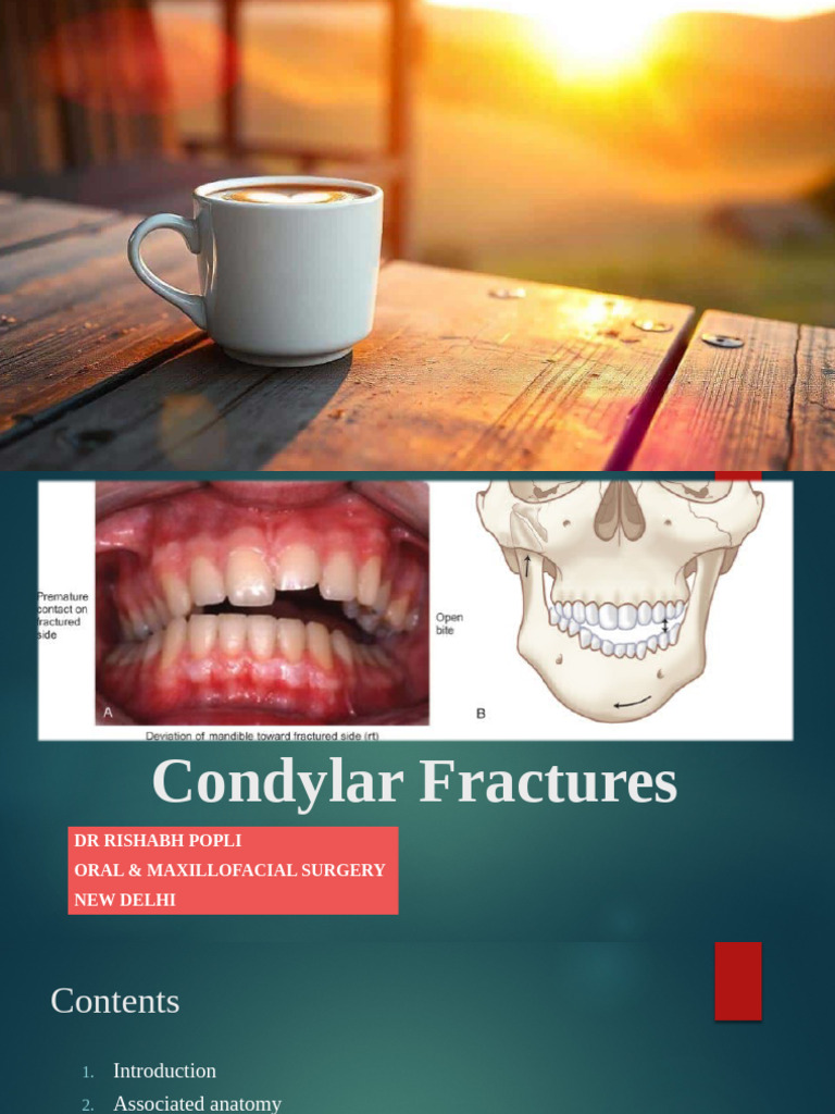 Condylar Fractures Seminar | PDF | Ct Scan | Human Anatomy
