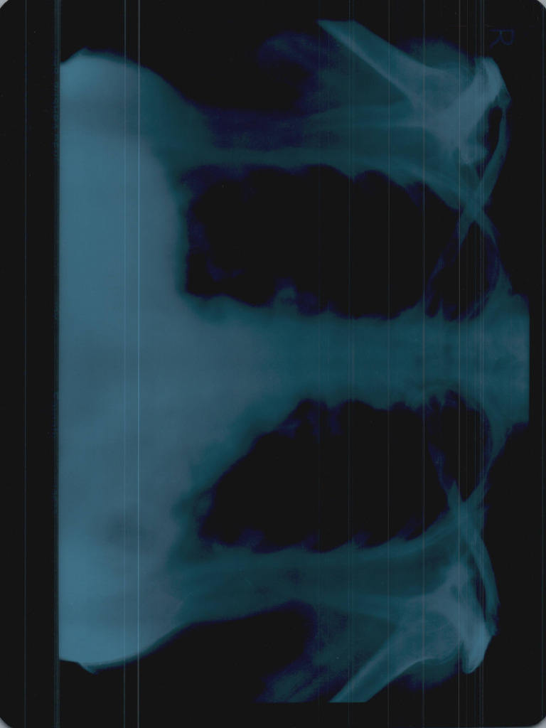 Pushpa Devi Treatment Paper | PDF