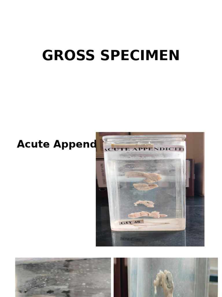Pathology Specimen Overview List | PDF